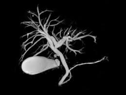 MRCP Dubai by 3 tesla mri